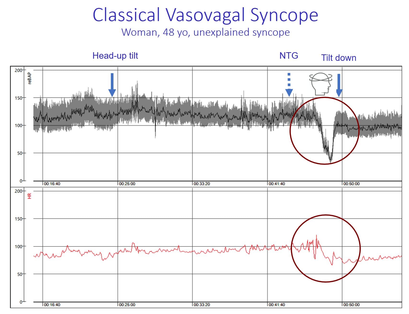 dysautonomia test
